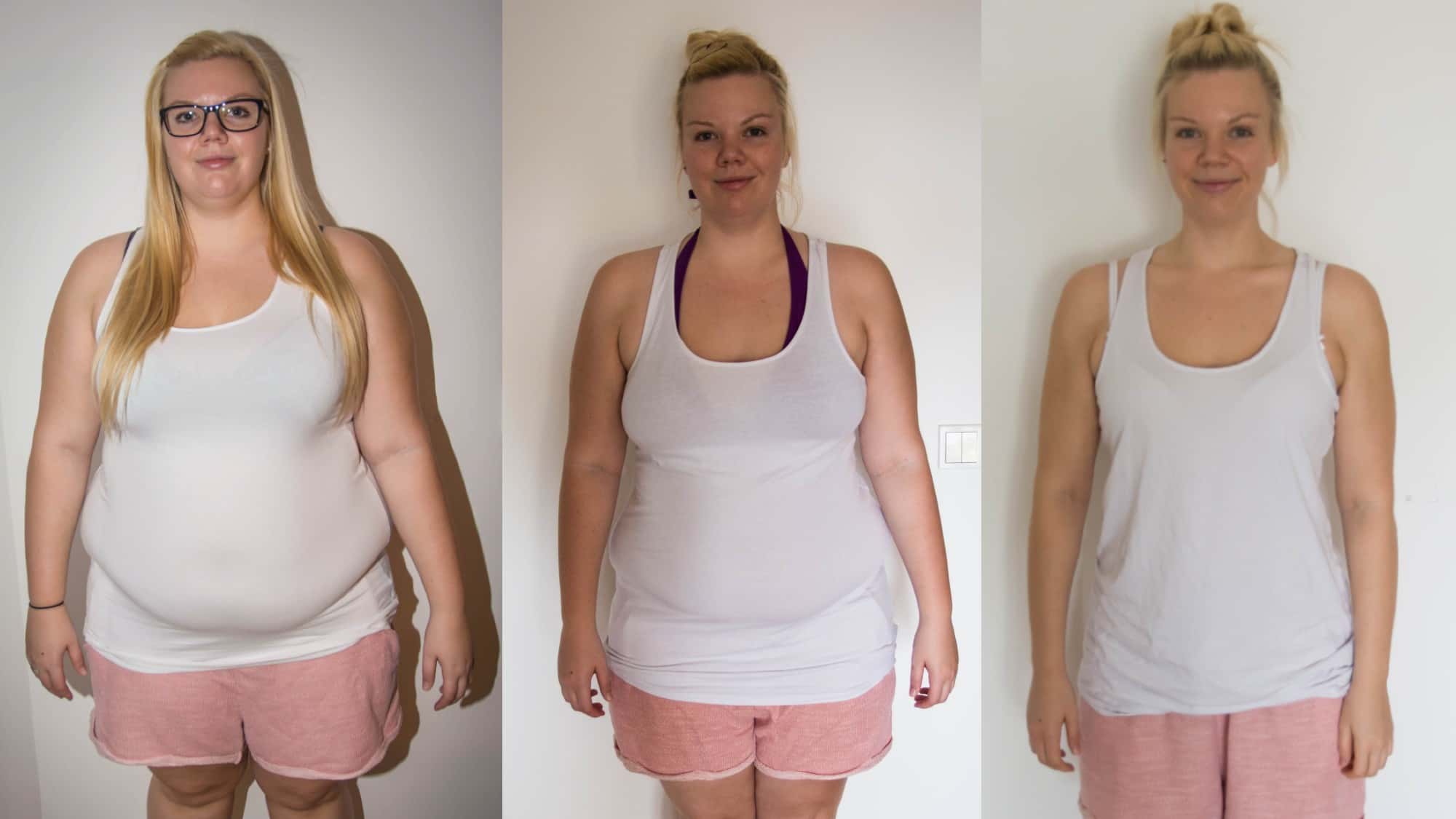 Influencerin Susi: "So nahm ich 50 Kilo ab, das sind die Folgen"